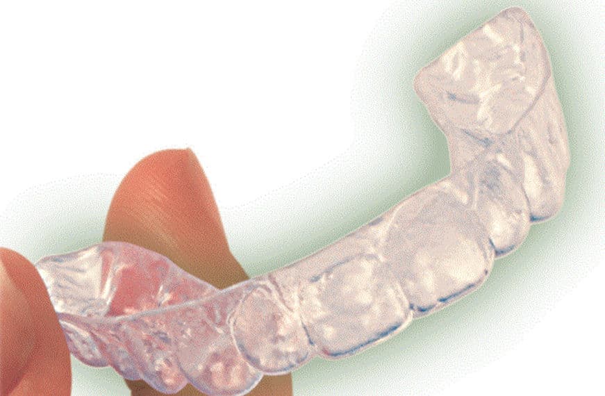 Smiletru Invisible Aligners Advantage Dental